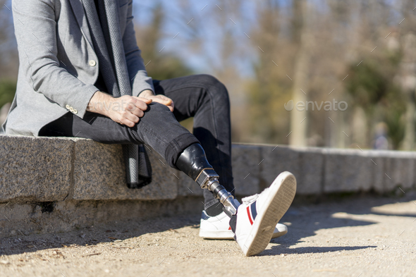 Young man missing a leg putting on a prosthetic leg Stock Photo by ...
