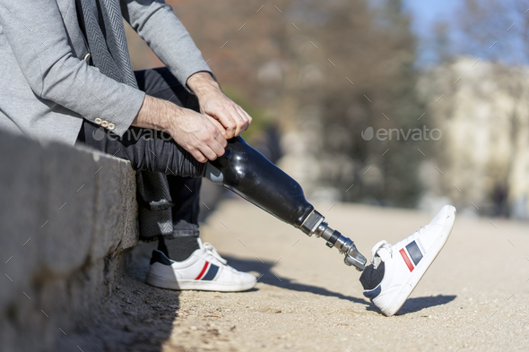 Young man missing a leg putting on a prosthetic leg Stock Photo by ...