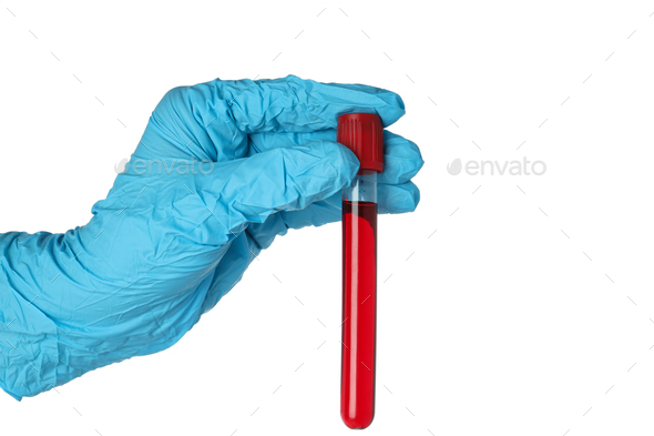 PNG,Human blood in test tubes, isolated on white background Stock Photo ...