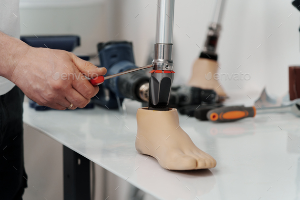Master screwing and tightening metal part of modern prosthetic leg ...