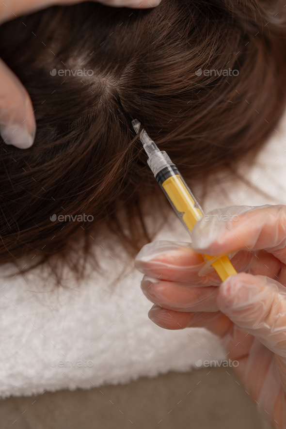 A beautician makes injections into the scalp for hair growth ...