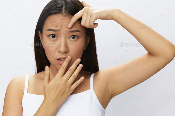 Asian woman facial skin problems, acne and inflammation, red rashes and ...