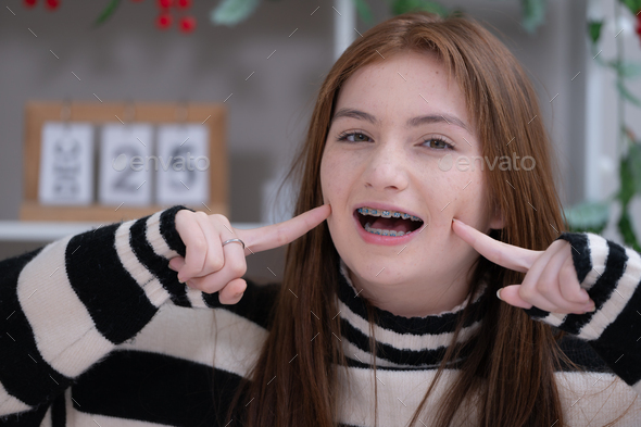 Portrait of Teenage girls with braces on her teeth Stock Photo by wosunan