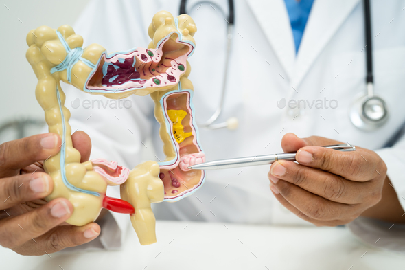 Intestine, appendix and digestive system, doctor holding anatomy model ...