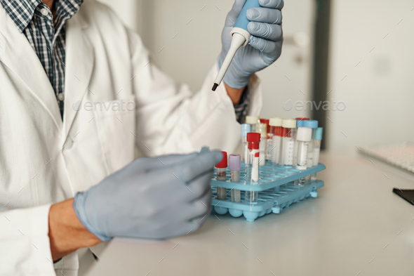 Close up of scientist is using micropipette for biochemical test ...