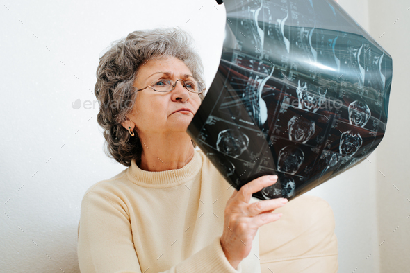 Elderly and health care, radiography. Senior sick woman patient ...
