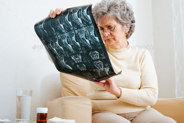 Elderly and health, radiography, bone joint disease concept Senior ...