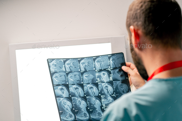 frame of an MRI image on a special board an accurate and detailed a ...