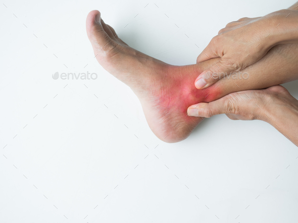 Sore ankle Pain Foot Woman, Sprain Feet Heel Knee Sore People Stock ...