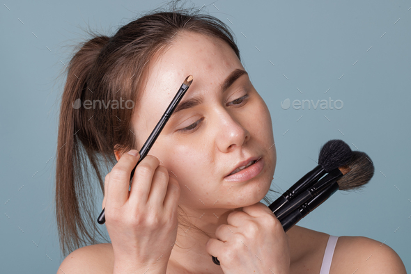 A girl with acne sticks an acne patch on her cheek. Using mini plaster ...