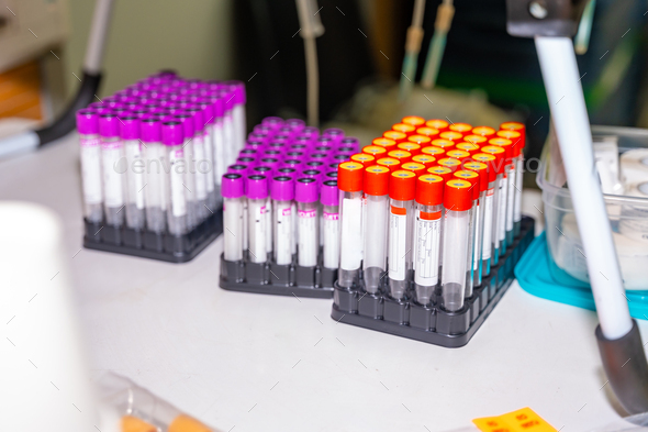 Samples of blood labeled on a table Stock Photo by Unai82 | PhotoDune