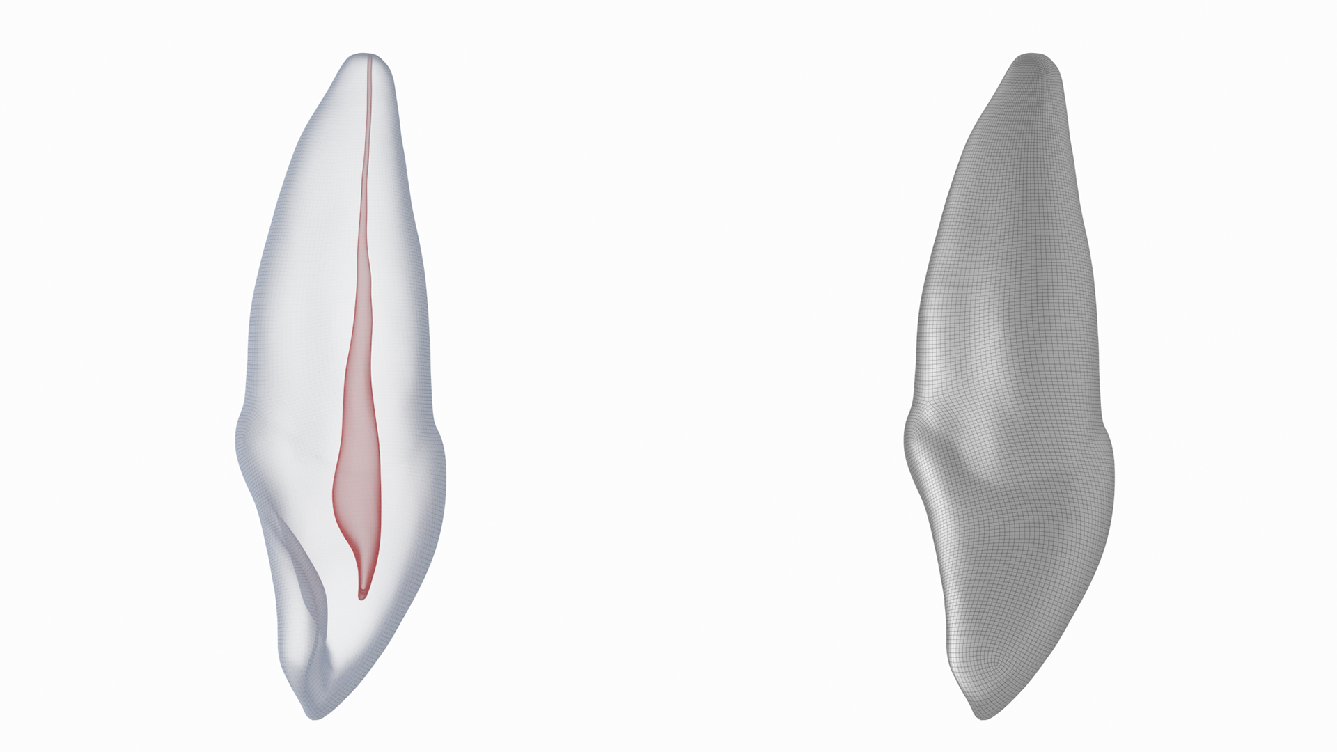 Human Upper Left Central Incisor Tooth With Pulp Cavity by valeriik