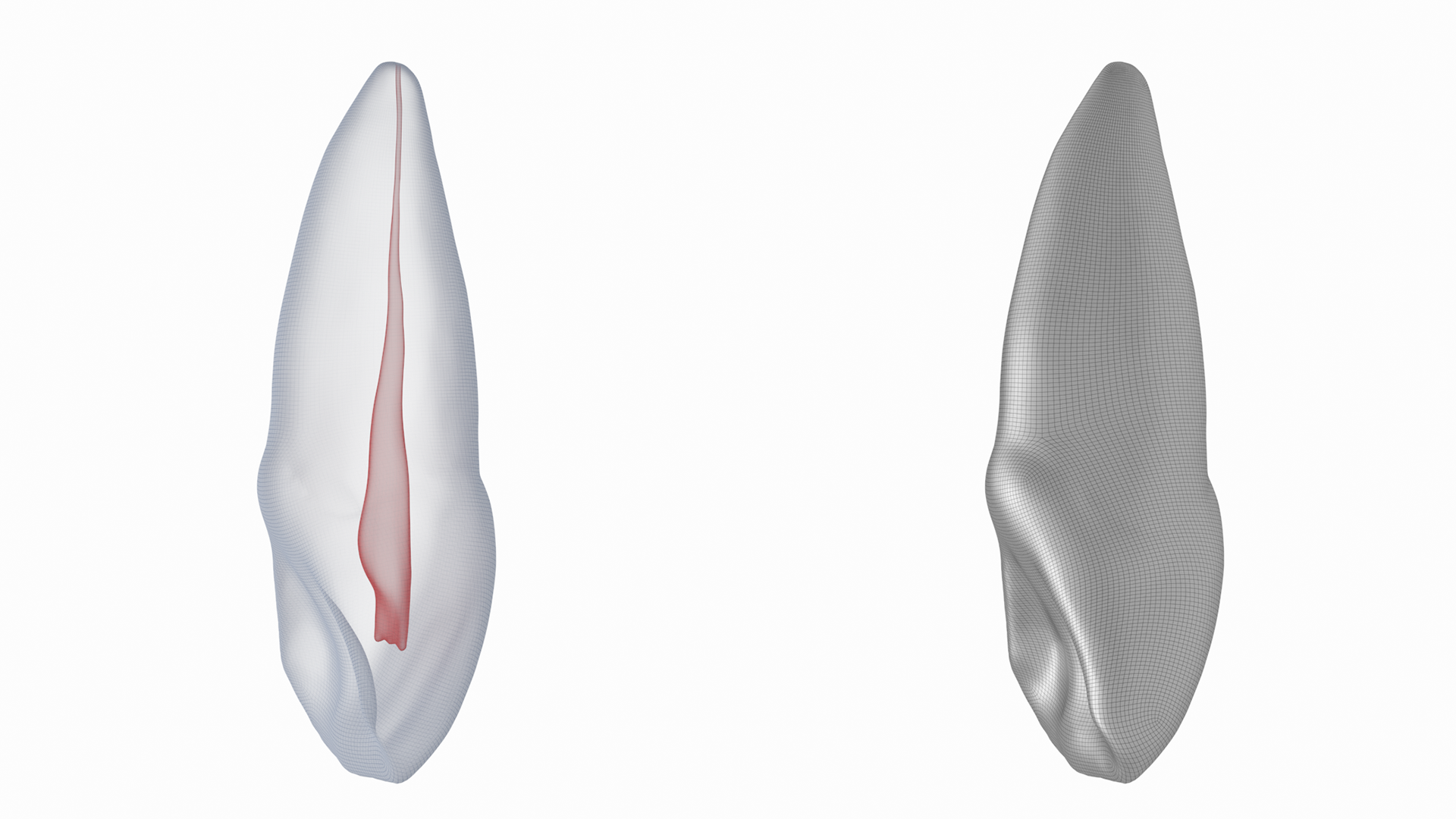 Human Upper Left Central Incisor Tooth With Pulp Cavity by valeriik