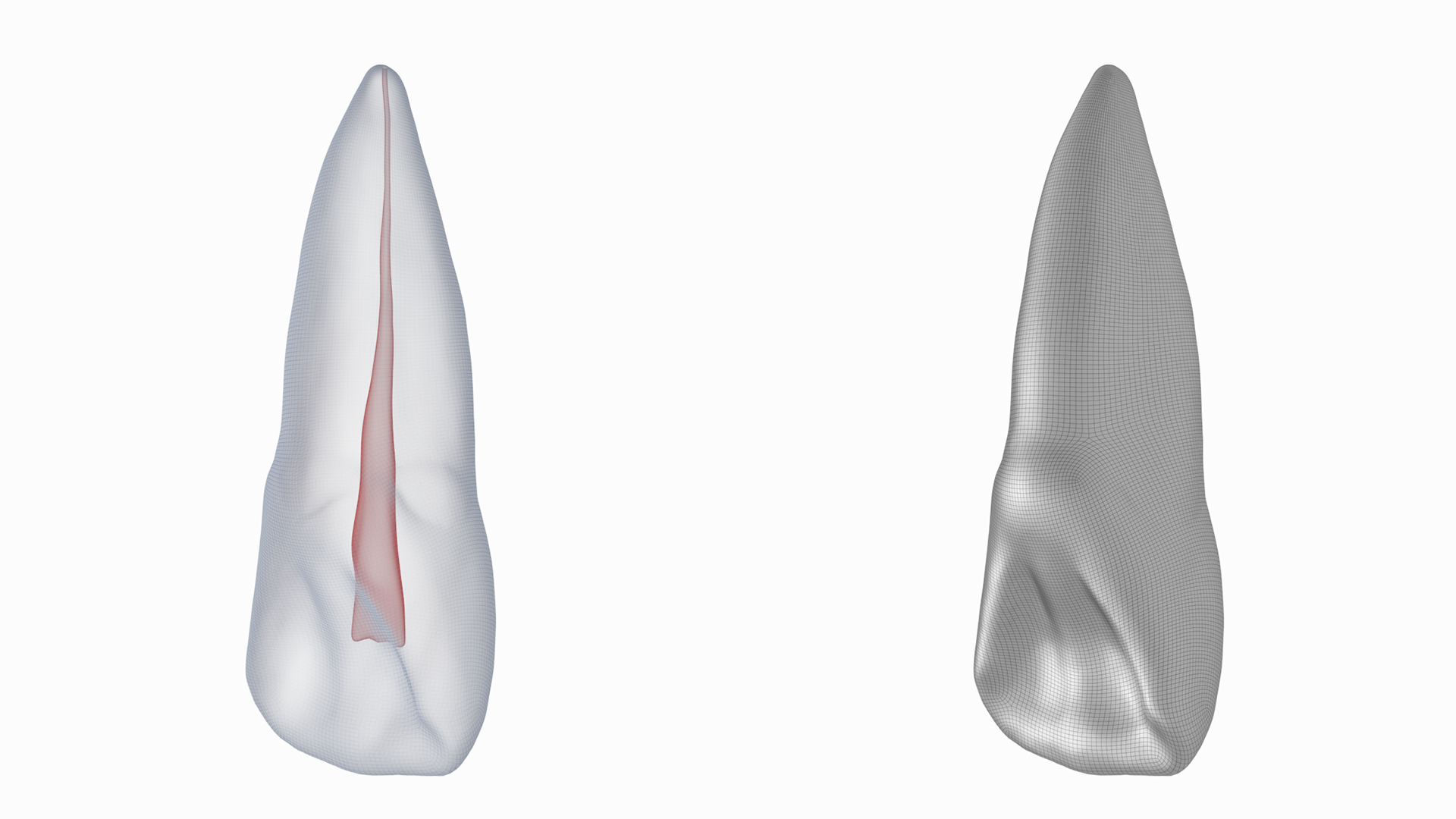 Human Upper Left Central Incisor Tooth With Pulp Cavity by valeriik