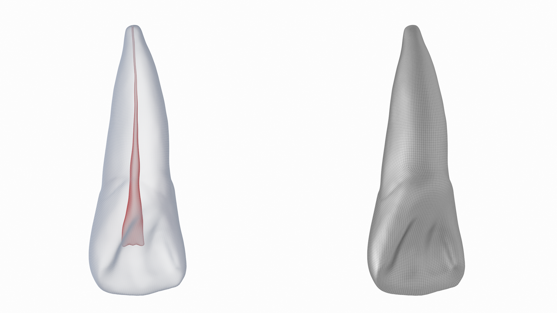 Human Upper Left Central Incisor Tooth With Pulp Cavity by valeriik