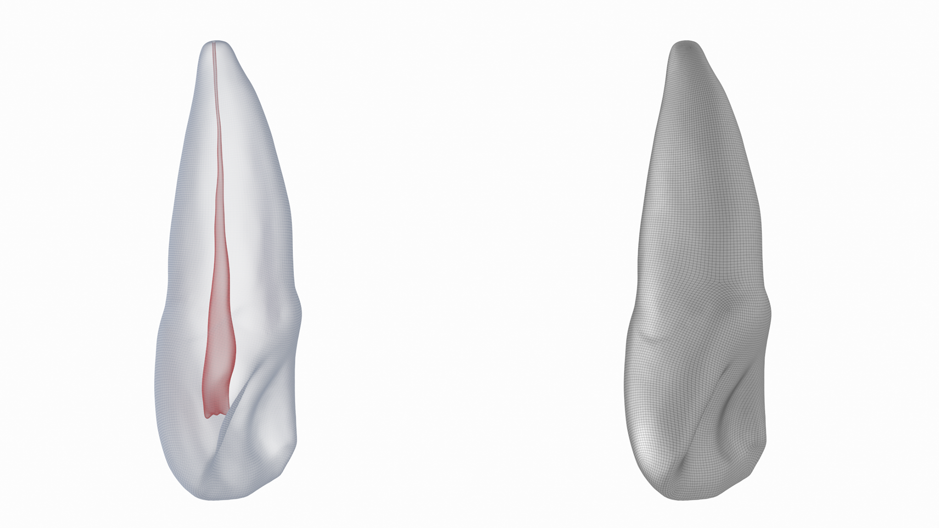 Human Upper Left Central Incisor Tooth With Pulp Cavity by valeriik