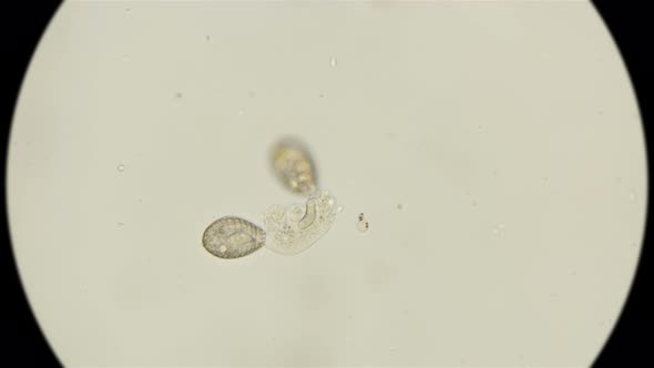 infusoria Coleps, class Ciliata, under a microscope, Stock Footage