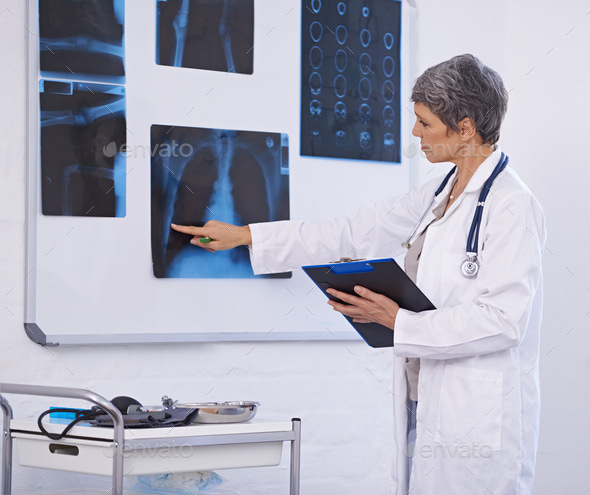 Improving her skills in radiology Stock Photo by YuriArcursPeopleimages