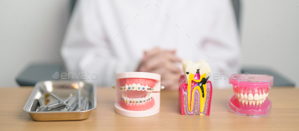 Tooth Anatomy and Orthodontic model on dentist table. Stock Photo by ...