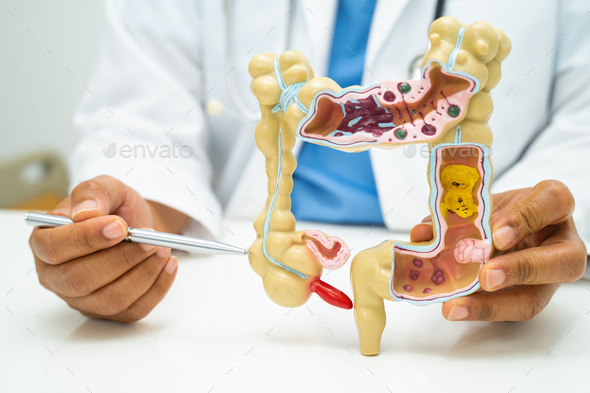 Intestine, appendix and digestive system, doctor holding anatomy model ...