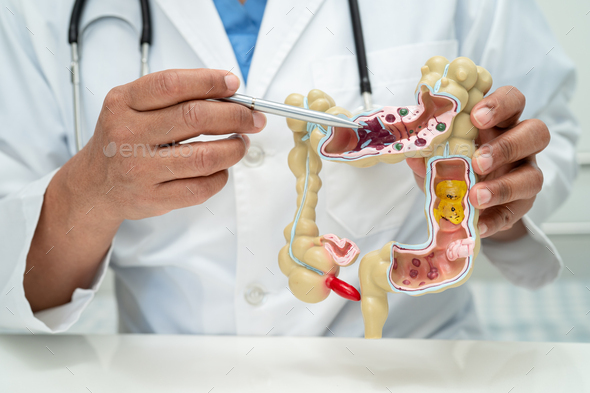Intestine, appendix and digestive system, doctor holding anatomy model ...