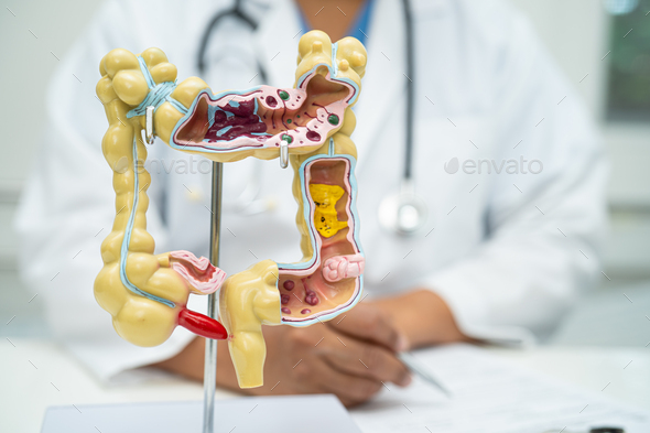 Intestine, appendix and digestive system, doctor holding anatomy model ...