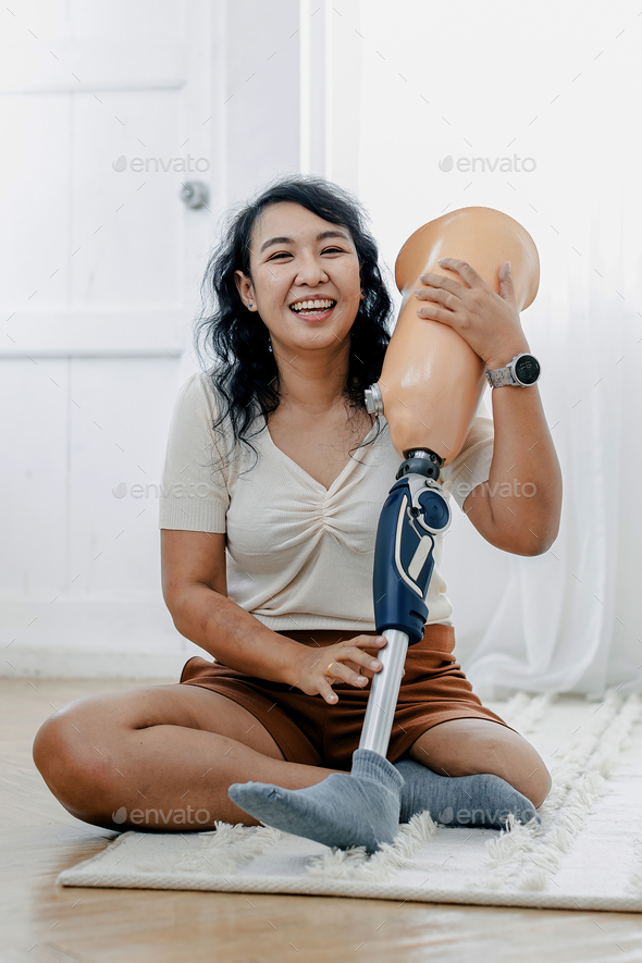 Woman hug prosthetic leg livingroom. applying leg prosthetic concept ...