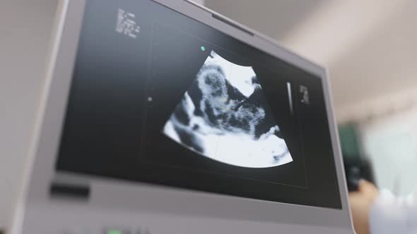 Using Prenatal Ultrasound Scan Equipment For Health Examination Of ...