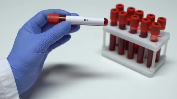 RBC Test, Doctor Showing Blood Sample in Tube, Lab Research, Health ...