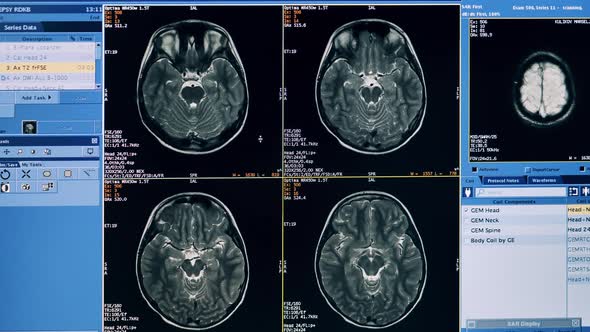 MRI Program Interface During Brain Scanning, Stock Footage | VideoHive