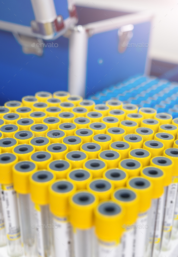 preparing tubes for collecting blood samples in the laboratory lab ...