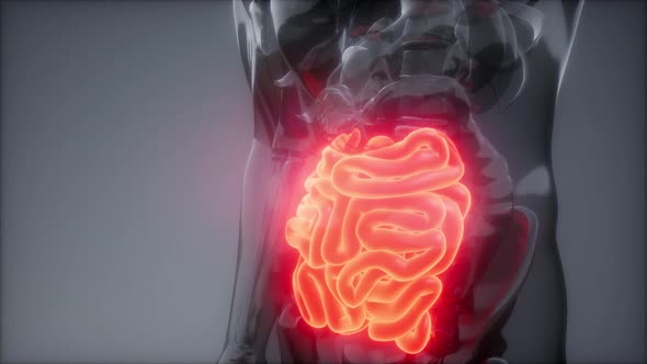 Human Small Intestine Radiology Exam, Motion Graphics | VideoHive