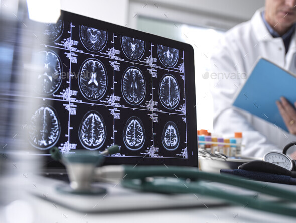 Healthcare professional analyzing brain MRI scans on a computer monitor ...
