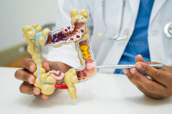 Intestine, appendix and digestive system, doctor holding anatomy model ...
