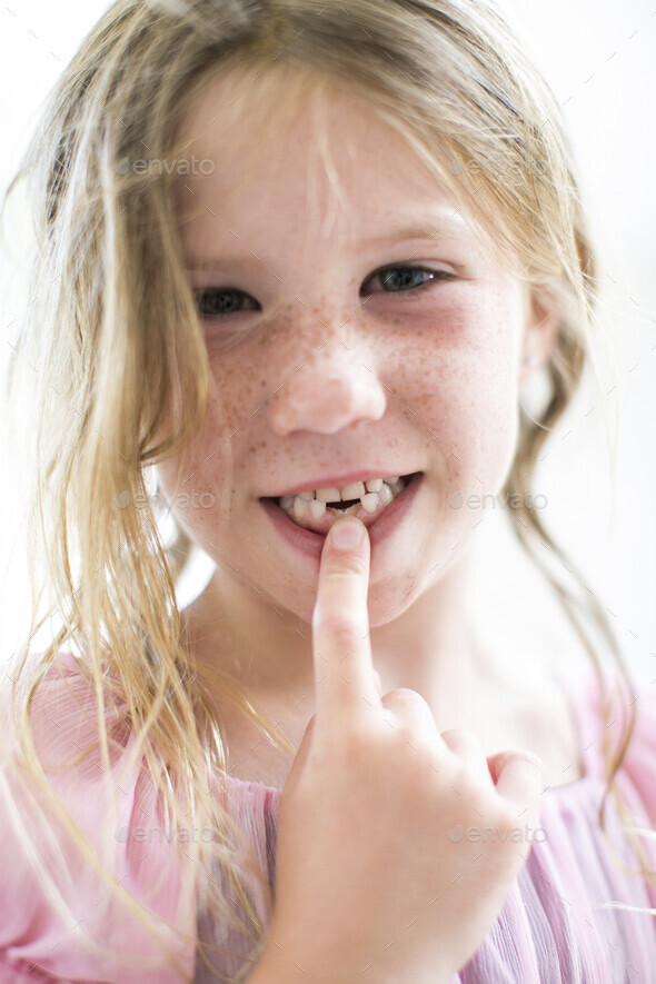Young girl showing off her missing front tooth with a smile Stock Photo ...