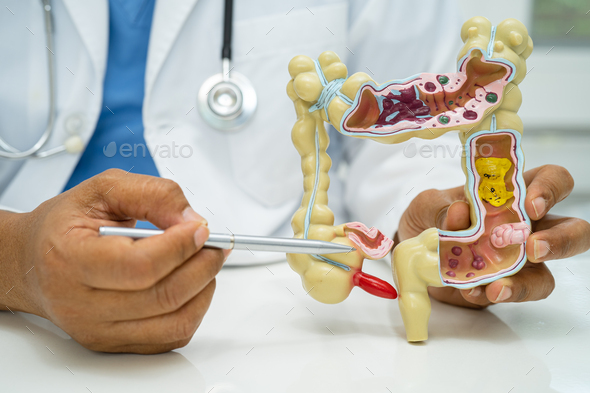 Intestine, appendix and digestive system, doctor holding anatomy model ...