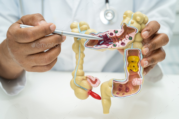 Intestine, appendix and digestive system, doctor holding anatomy model ...
