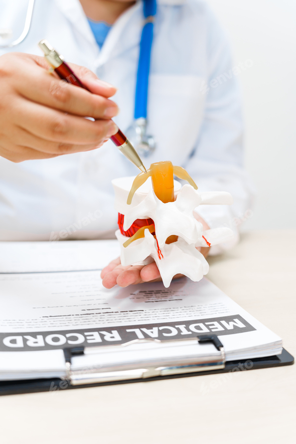A doctor uses an anatomical lumbar disc herniation model to explain ...