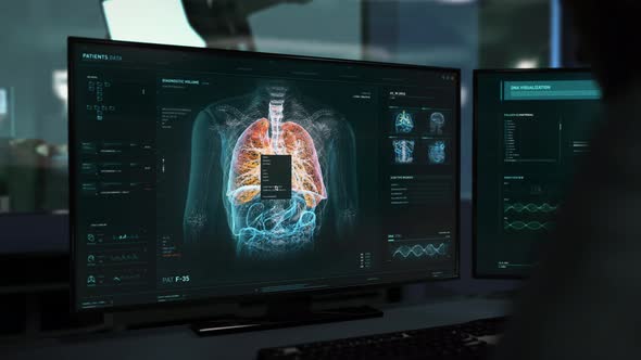 Biological Research Of Lungs In Modern Medical Software Displayed On ...