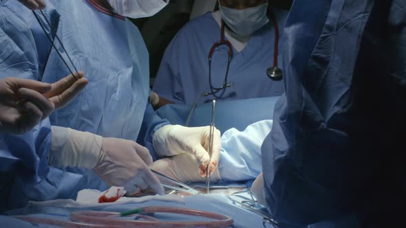 Surgeon Stitching Patient, Stock Footage | VideoHive