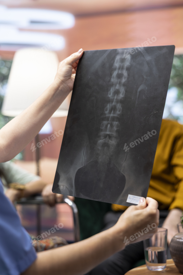 Nurse explaining radiography result to senior patients to understand ...