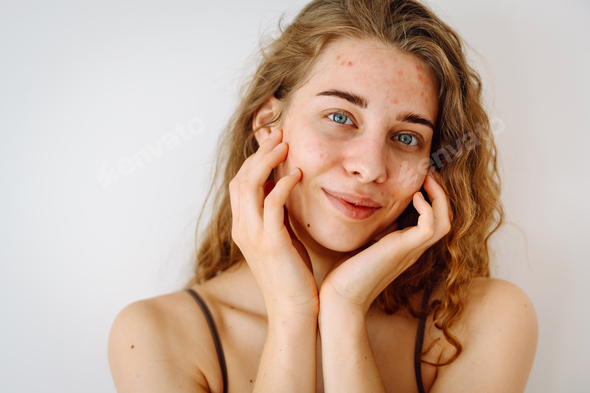 Cute woman with rashes on her face looks into a small mirror. Natural ...
