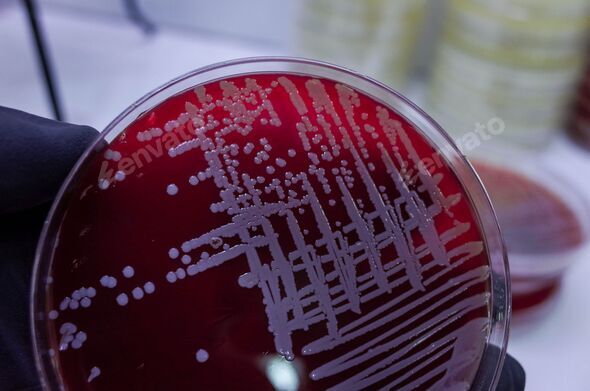 Bacterial colonies on red agar plate in a laboratory Stock Photo by ...