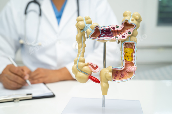 Intestine, appendix and digestive system, doctor holding anatomy model ...