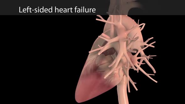 The Central Role of Left Atrium in Heart Failure, Motion Graphics ...