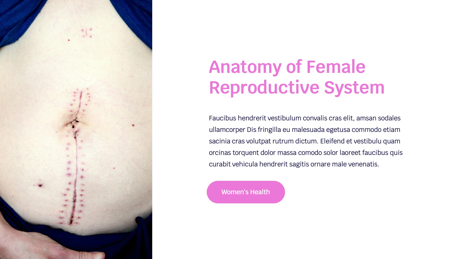 Gynecology Keynote Template, Presentation Templates | GraphicRiver