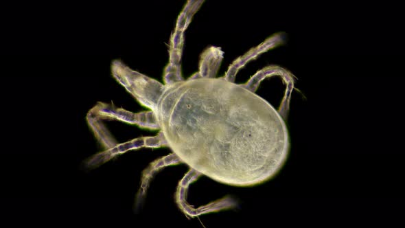 Acari, a Saprophage Mite, Under a Microscope, Stock Footage | VideoHive