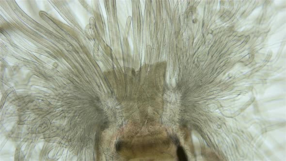 Worm Polychaeta of Family Terebellidae Under the Microscope Phylum ...