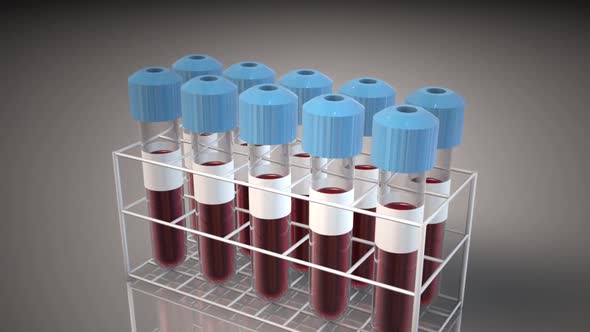 Provides an introduction to commonly used blood vials and research that ...