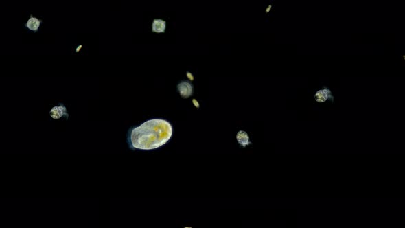 Plankton under a microscope, video: ciliates Bursaria, Halteria sp ...